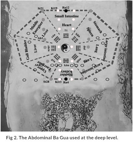 Abdominal Acupuncture – a Micro-System with Super Powers – Eastern Currents