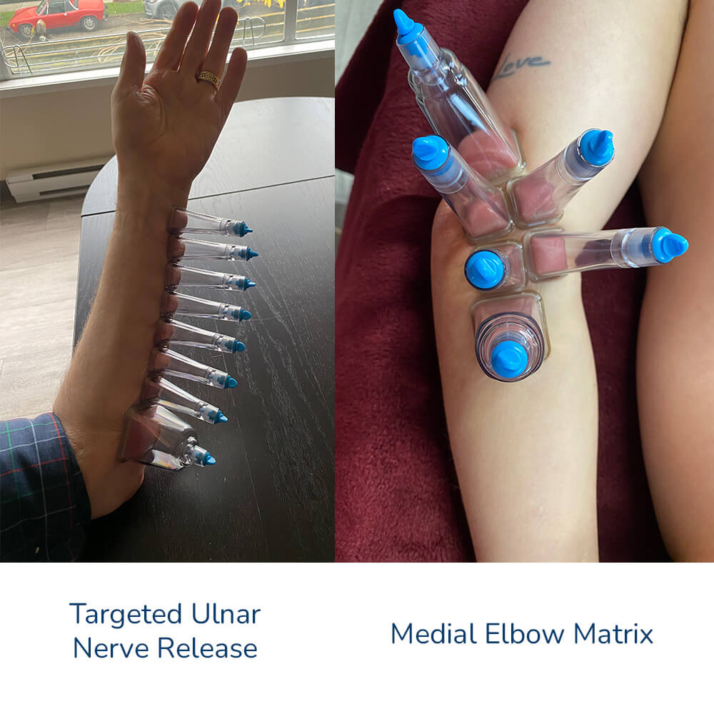 Fascia Buddy Square Cupping Set – 20 pieces – Eastern Currents