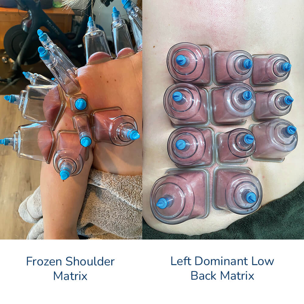 Fascia Buddy Square Cupping Set – 20 pieces – Eastern Currents