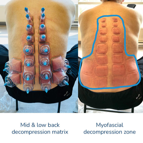 Fascia Buddy Square Cupping Set – 20 pieces – Eastern Currents