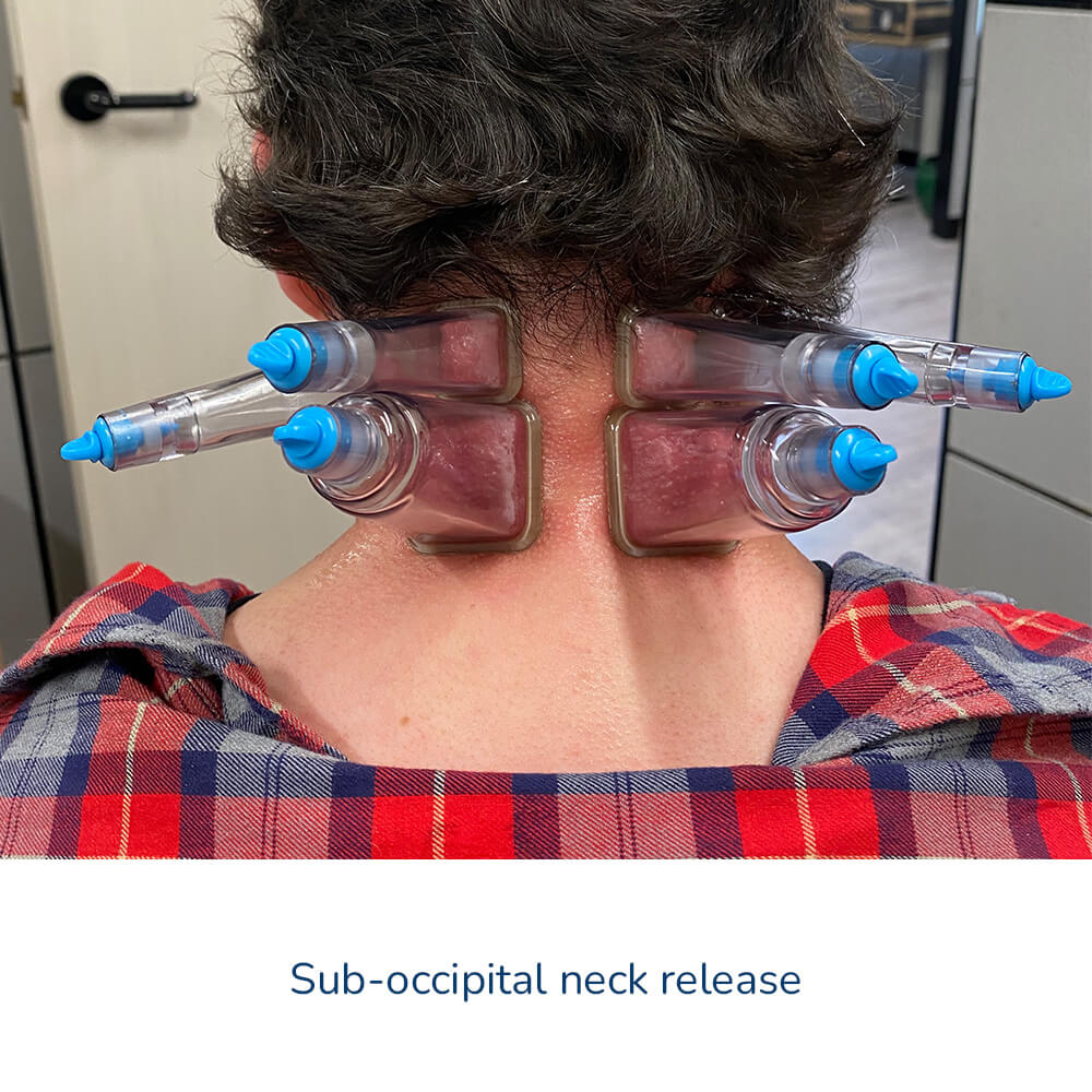 Fascia Buddy Square Cupping Set – 20 pieces – Eastern Currents